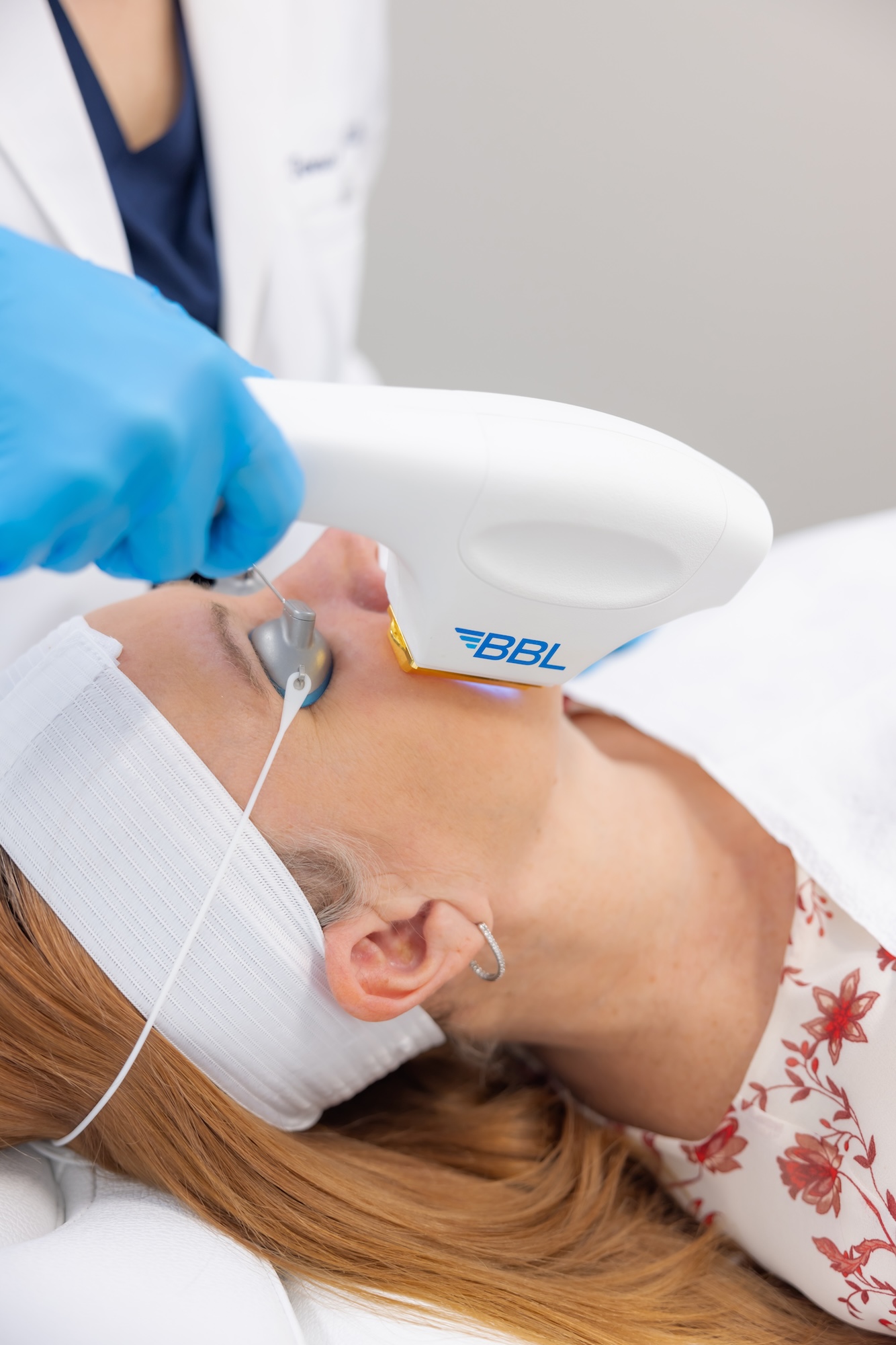 BBL Laser in New Canaan | Intentional Self Aesthetics